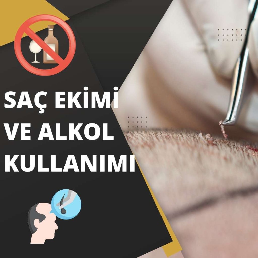 Saç Ekimi ve Alkol Kullanımı - Saç Ekimi Bilgi