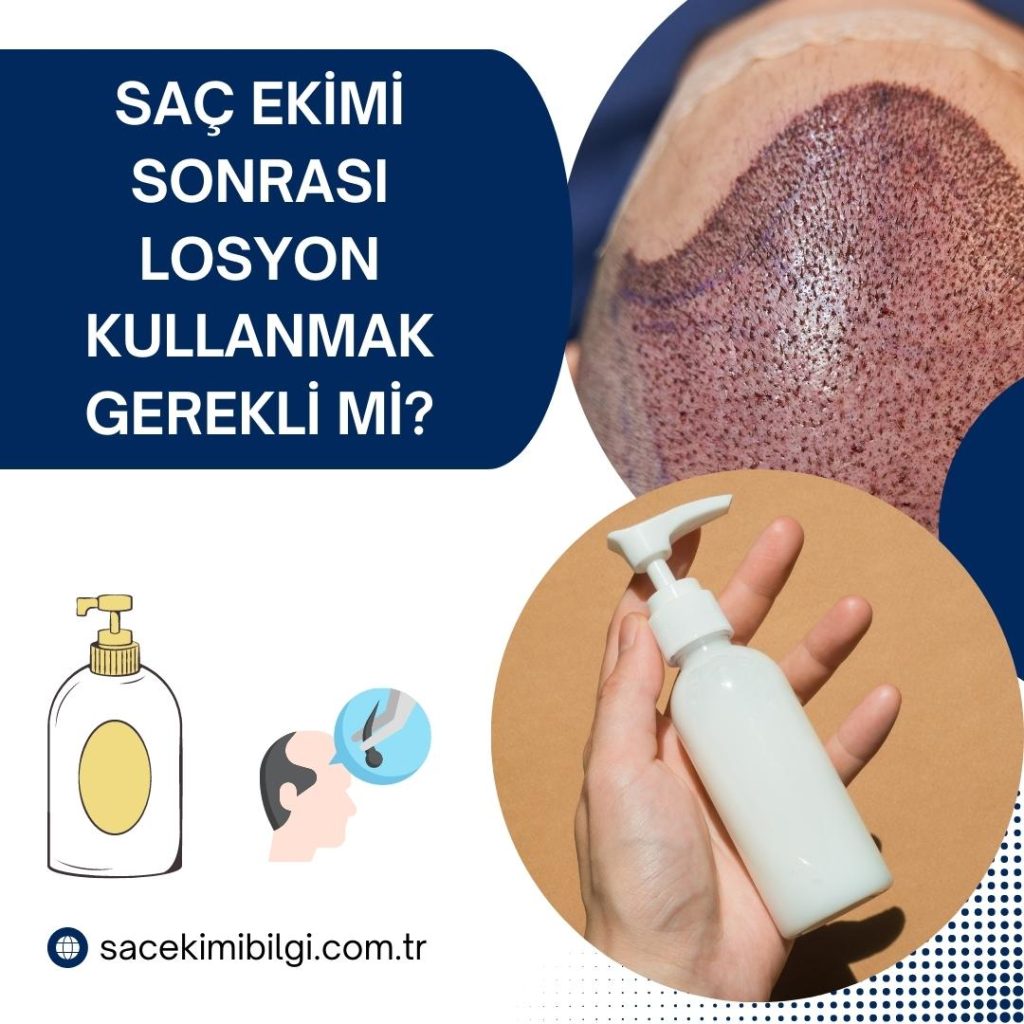 Saç Ekimi Sonrası Losyon Kullanmak Gerekli mi? - Saç Ekimi Bilgi